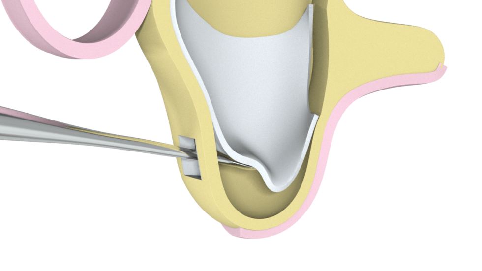 OstiumMax G | Laboratorios Bioxen