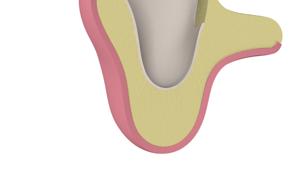 OstiumMax G | Laboratorios Bioxen